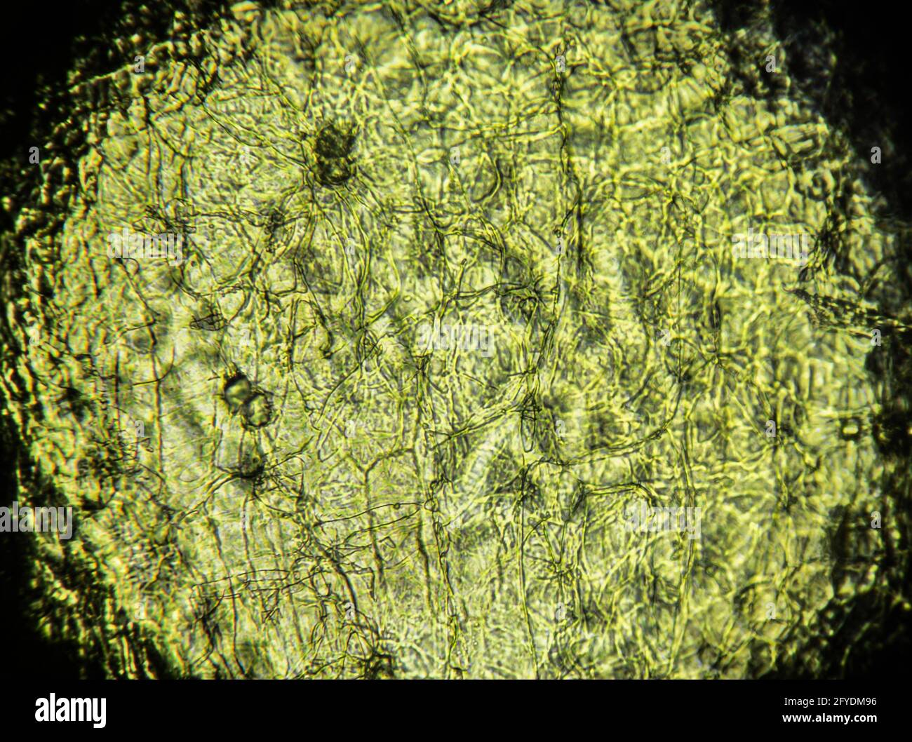 outer peel of orange seed under a light microscope, magnification 400 ...