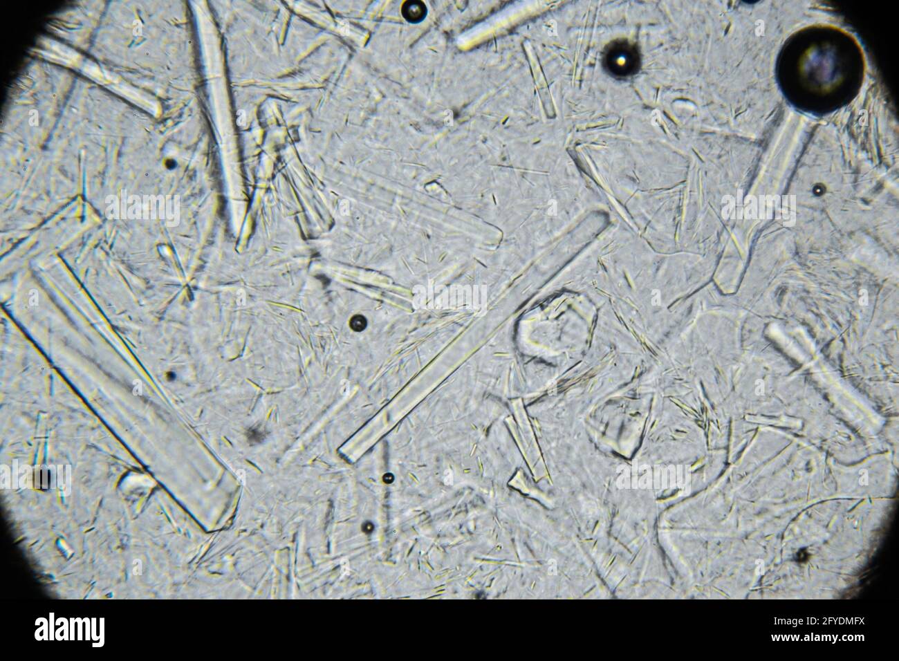 Artificial honey with large rectangular sugar crystals under microscope ...