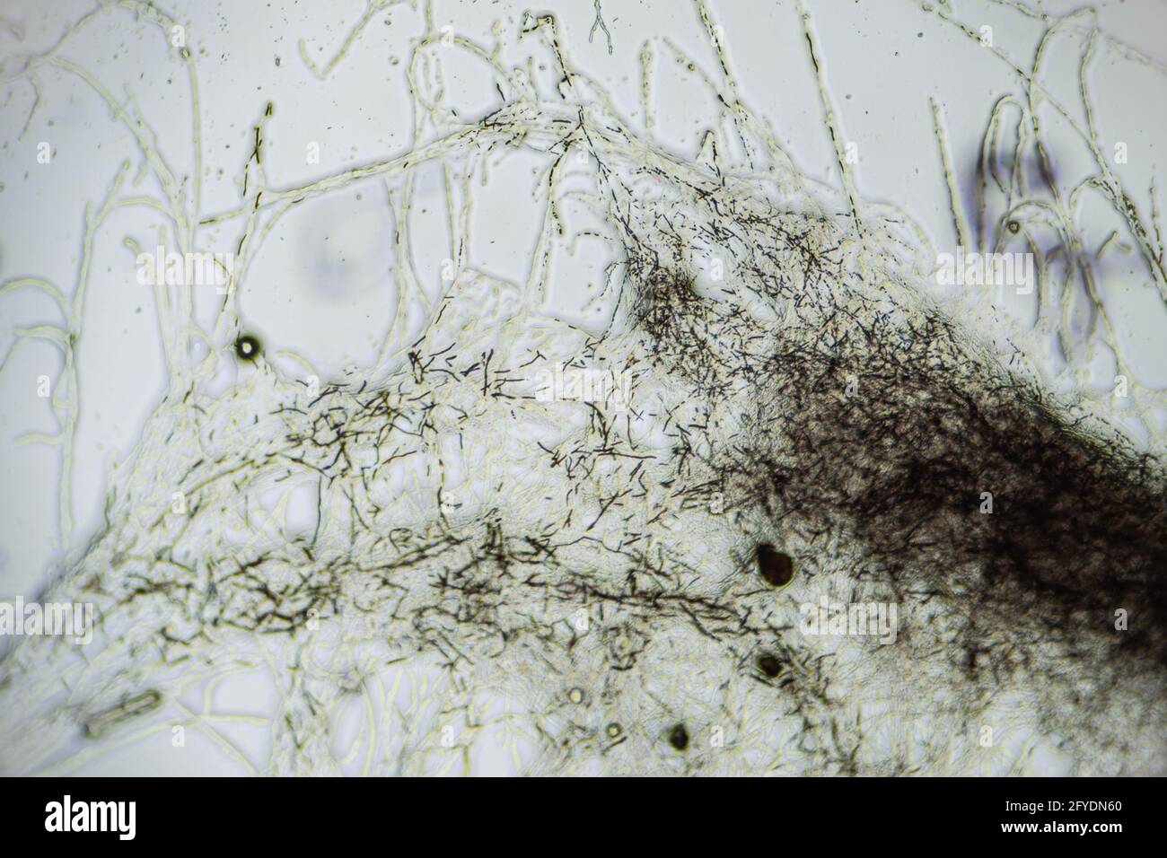 Kombucha tea macro close up under the light microscope, magnification ...
