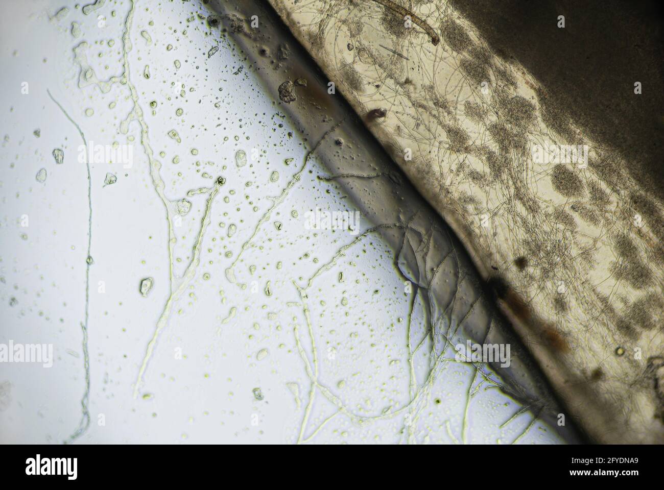 Kombucha tea macro close up under the light microscope, magnification ...