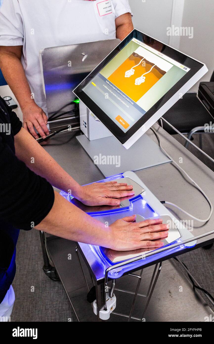Exploration of sweat function in a diabetic patient, SUDOSCAN ® is an ...