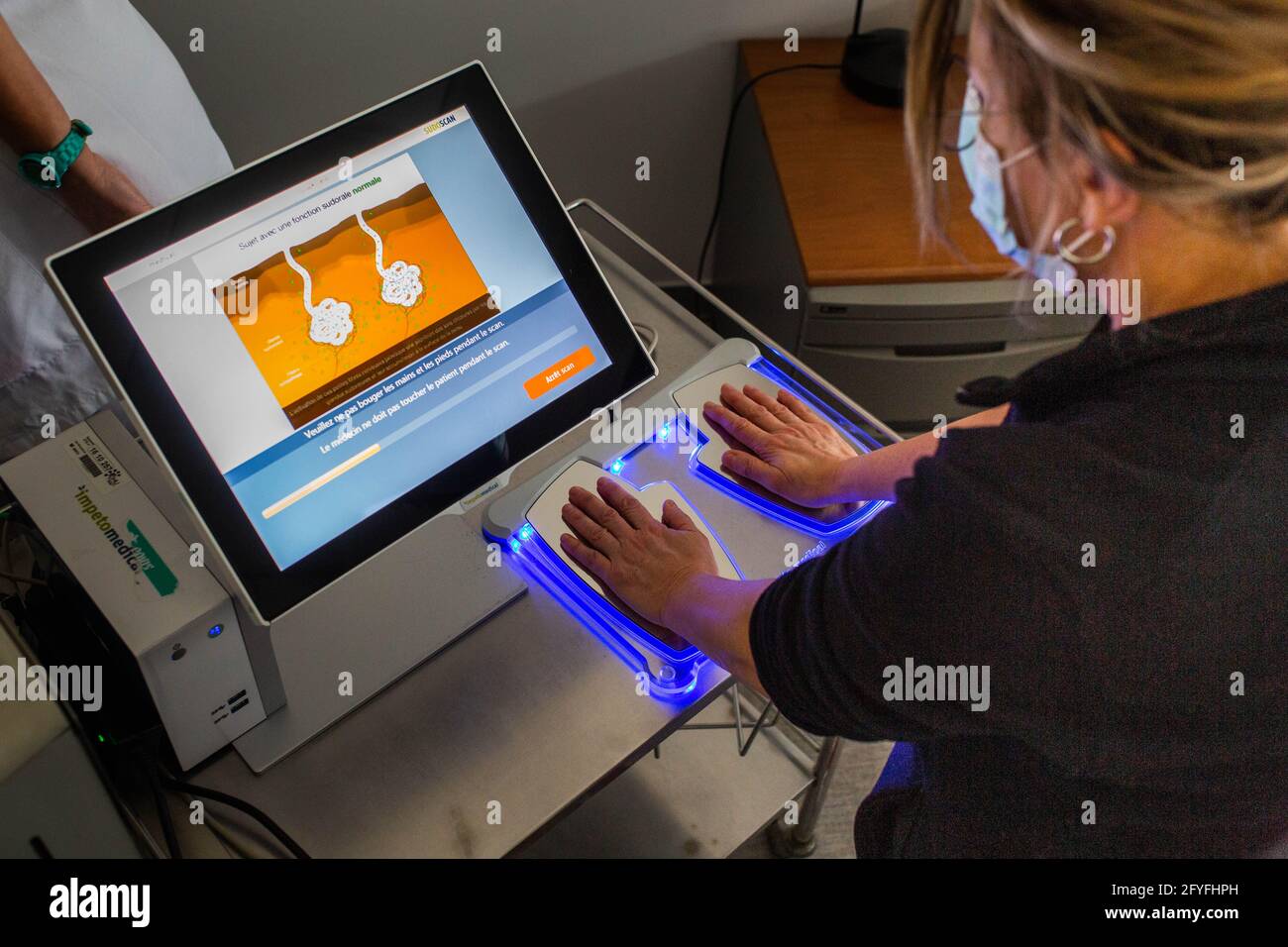 Exploration of sweat function in a diabetic patient, SUDOSCAN ® is an ...
