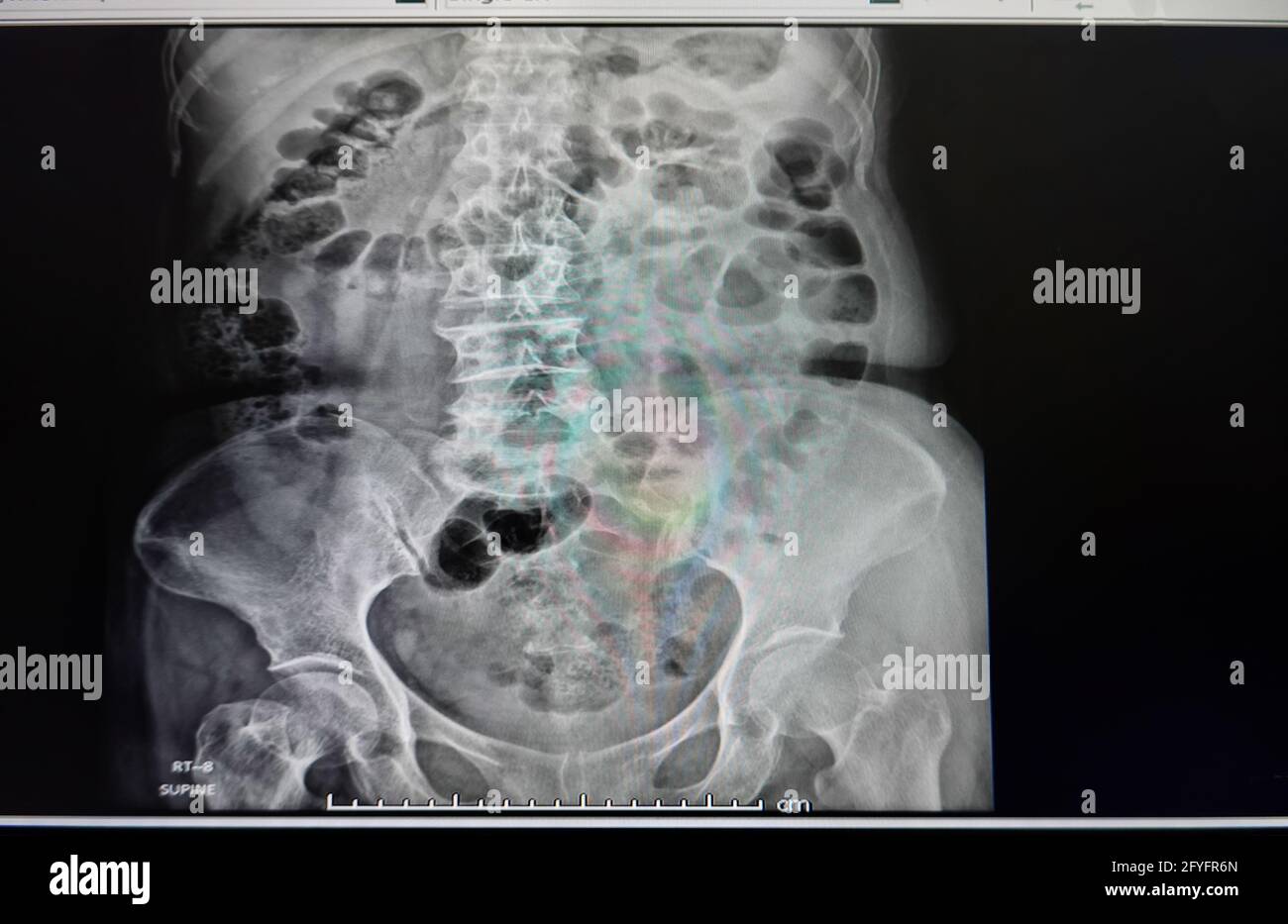 Real Mri Scans Of human body Stock Photo - Alamy