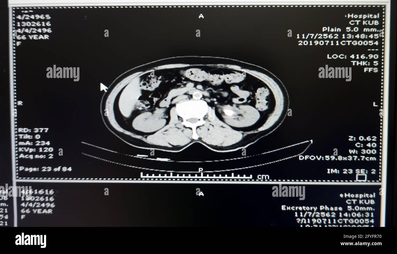Real Mri Scans Of human body Stock Photo - Alamy