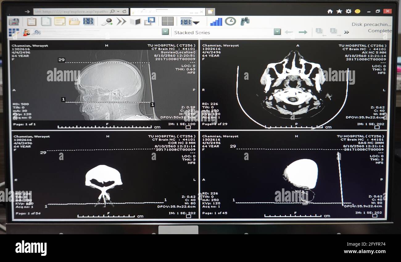 Real human brain laboratory hi-res stock photography and images - Alamy