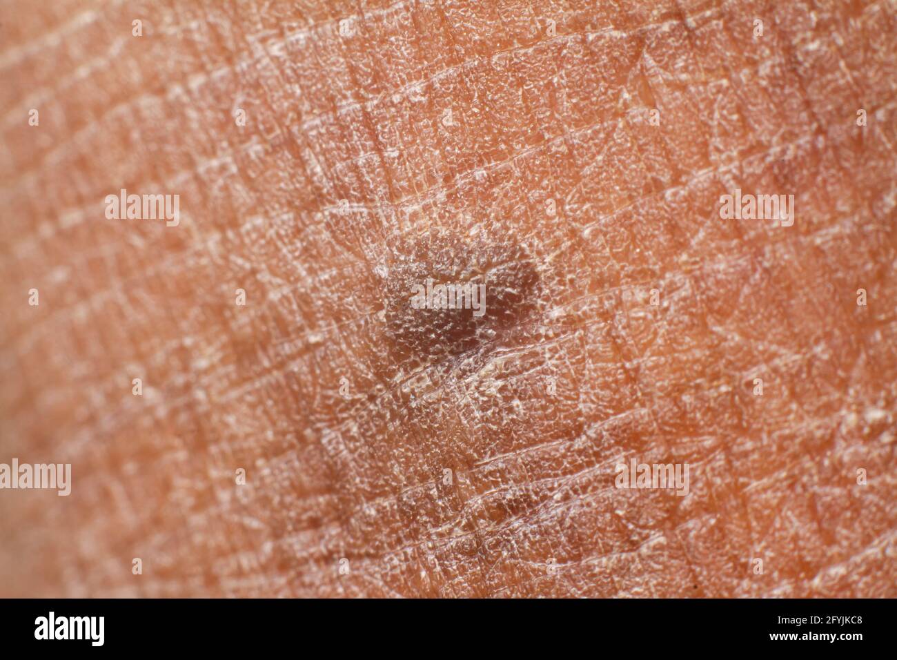 Close up skin texture with wrinkles on body human Stock Photo - Alamy