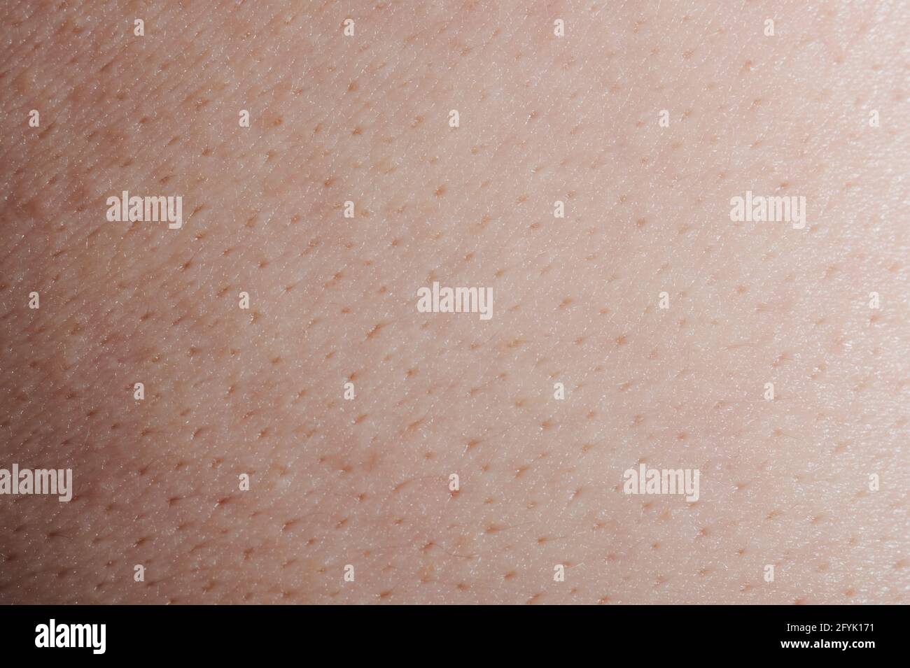Human skin with pores macro close up view. Clean skin texture Stock ...