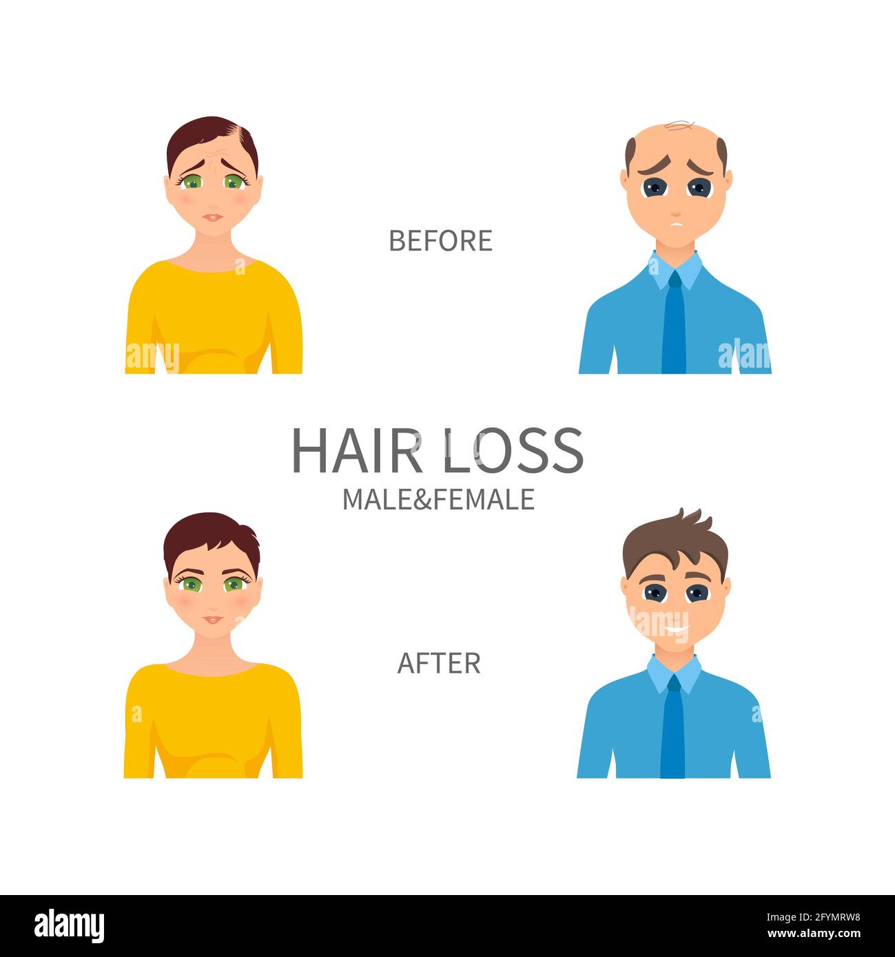 Female pattern baldness Cut Out Stock Images & Pictures - Alamy