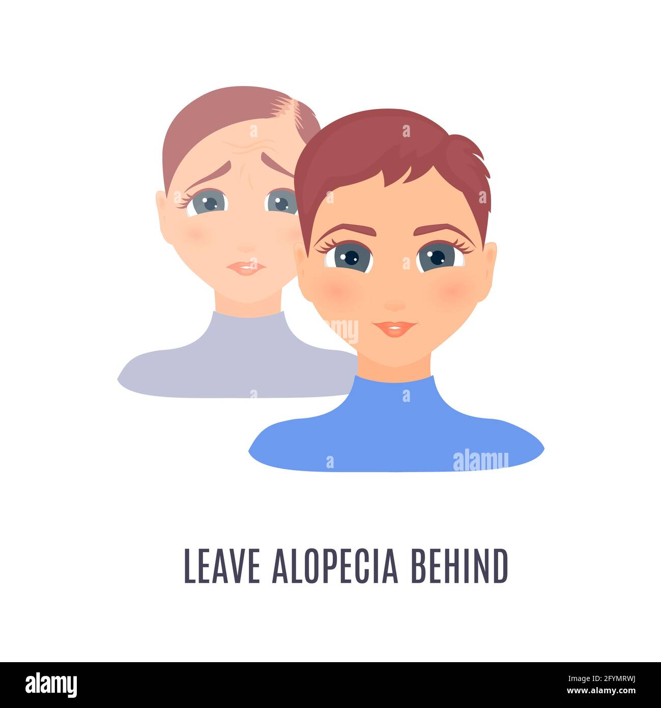Female alopecia treatment, conceptual illustration Stock Photo - Alamy Female alopecia treatment, conceptual illustration Stock Photo - Alamy