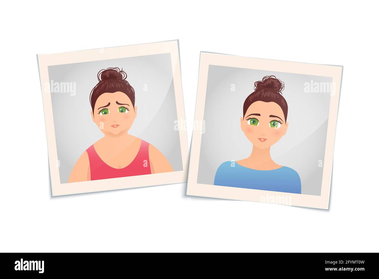 Before and after weight loss hi-res stock photography and images - Alamy