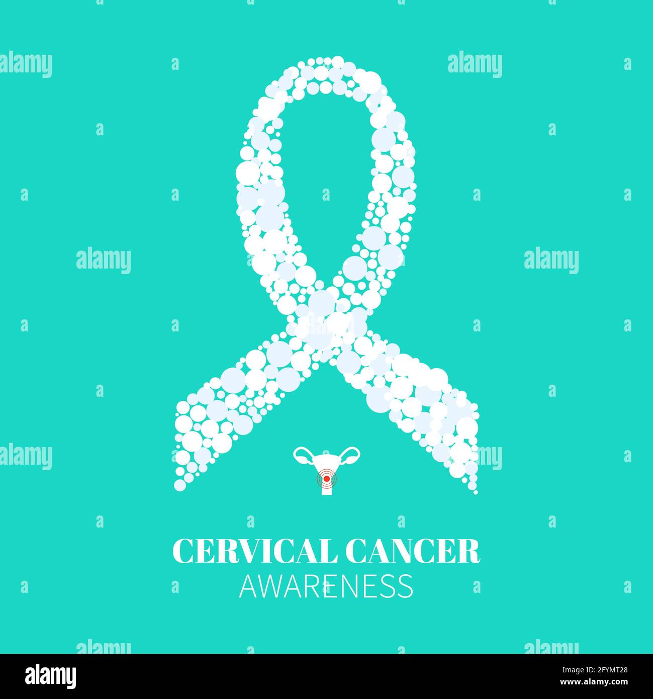 Cervical cancer, conceptual illustration Stock Photo - Alamy