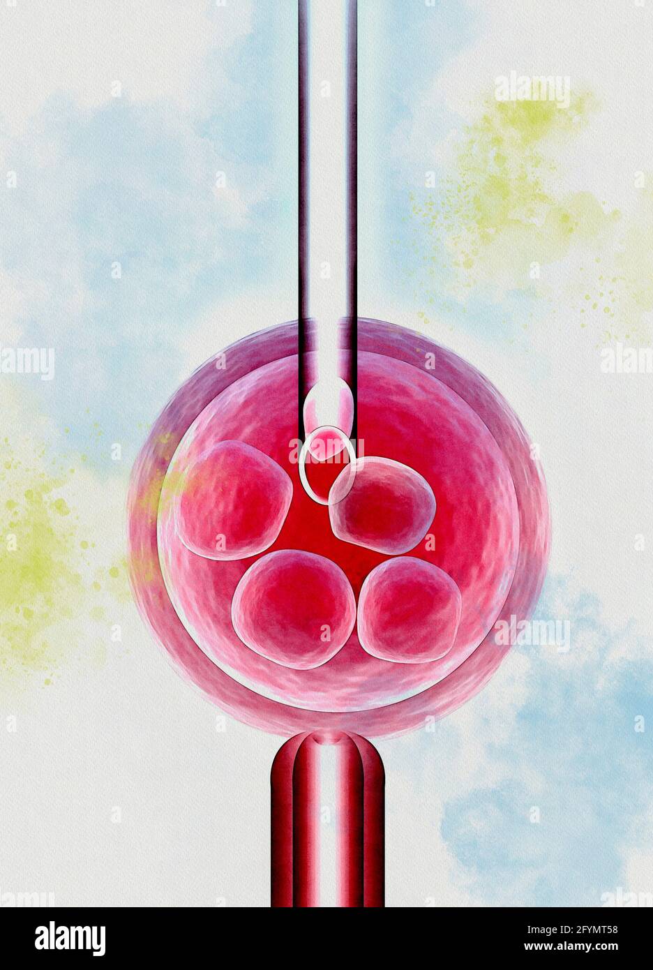 Ivf technique hi-res stock photography and images - Alamy