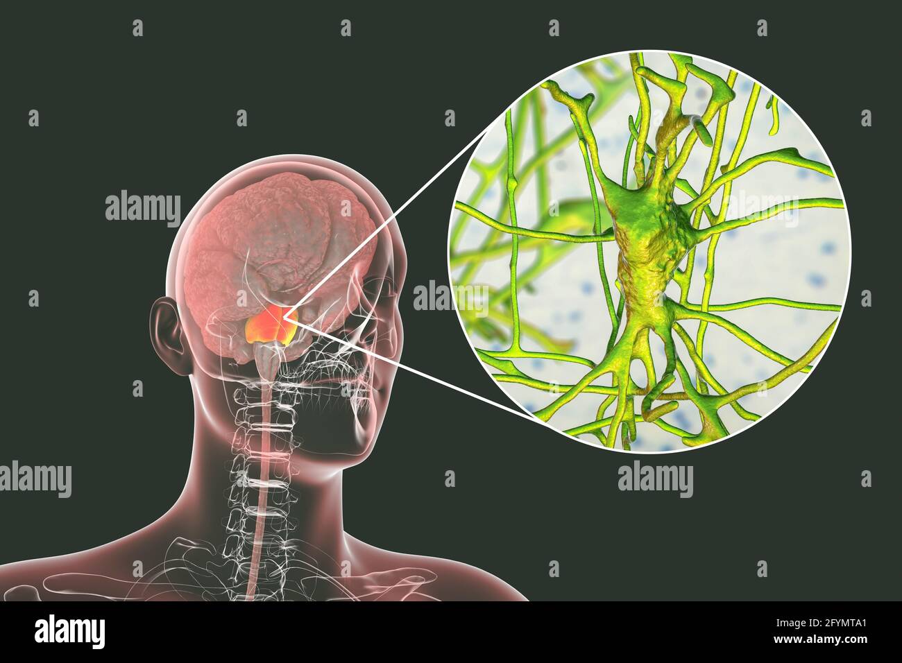 Human brain with highlighted pons and neurons, illustration Stock Photo ...