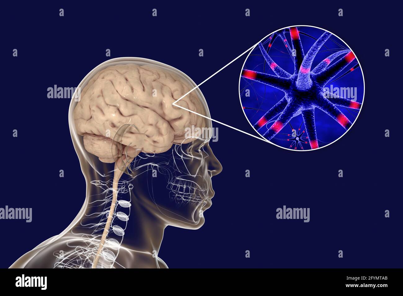 Cool Real Brain Pictures