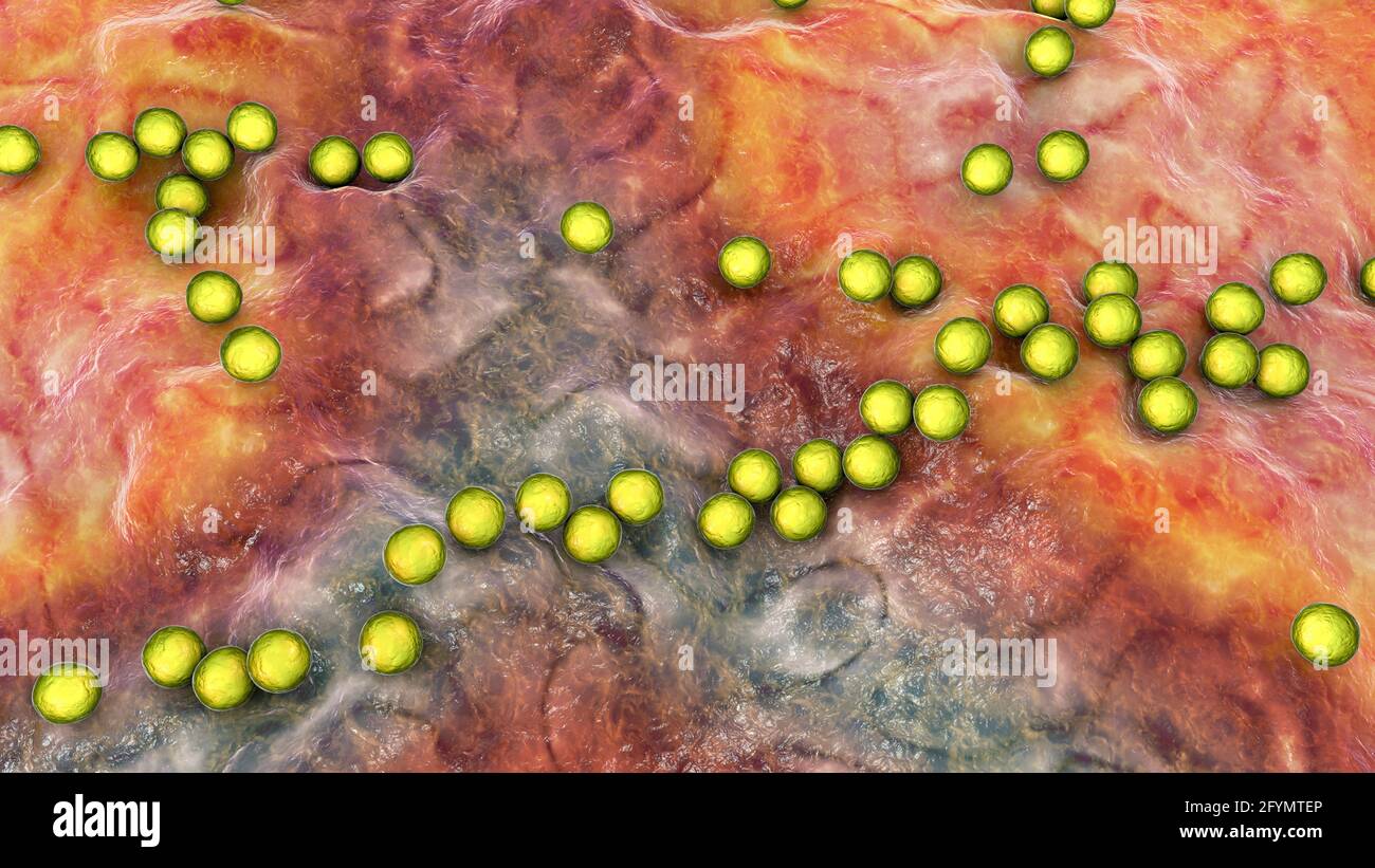 Streptococcus pyogenes bacteria, illustration Stock Photo - Alamy