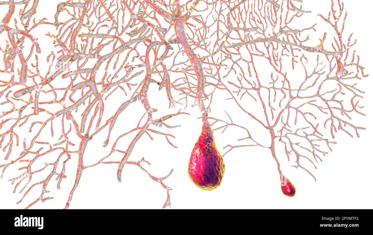 Purkinje nerve cells, illustration Stock Photo - Alamy