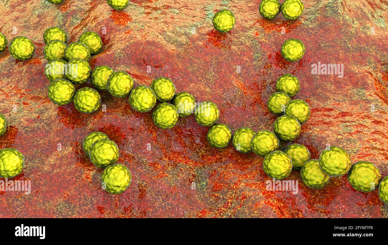 Streptococcus pyogenes bacteria, illustration Stock Photo - Alamy