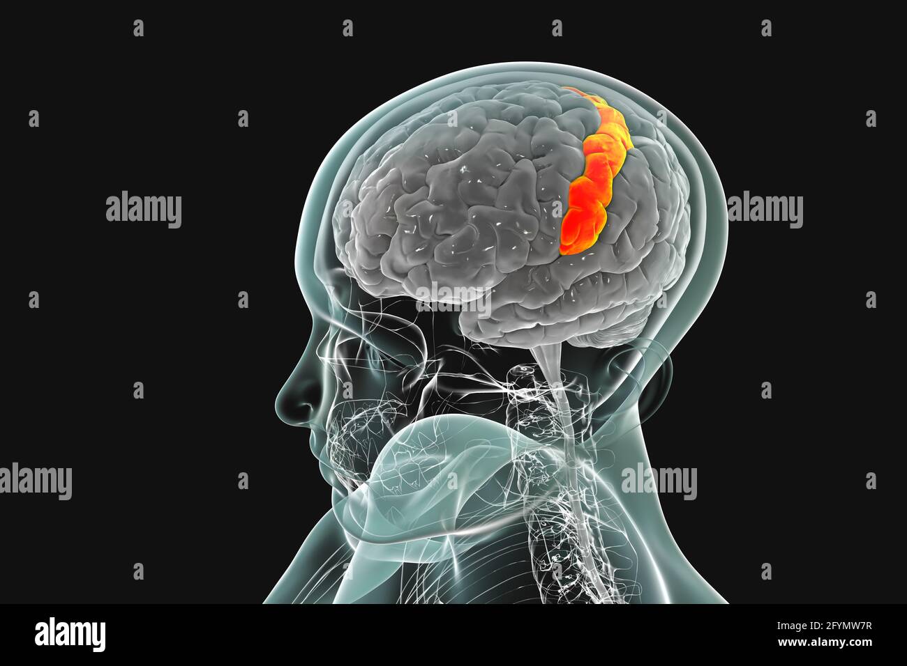 Postcentral Gyrus Mri