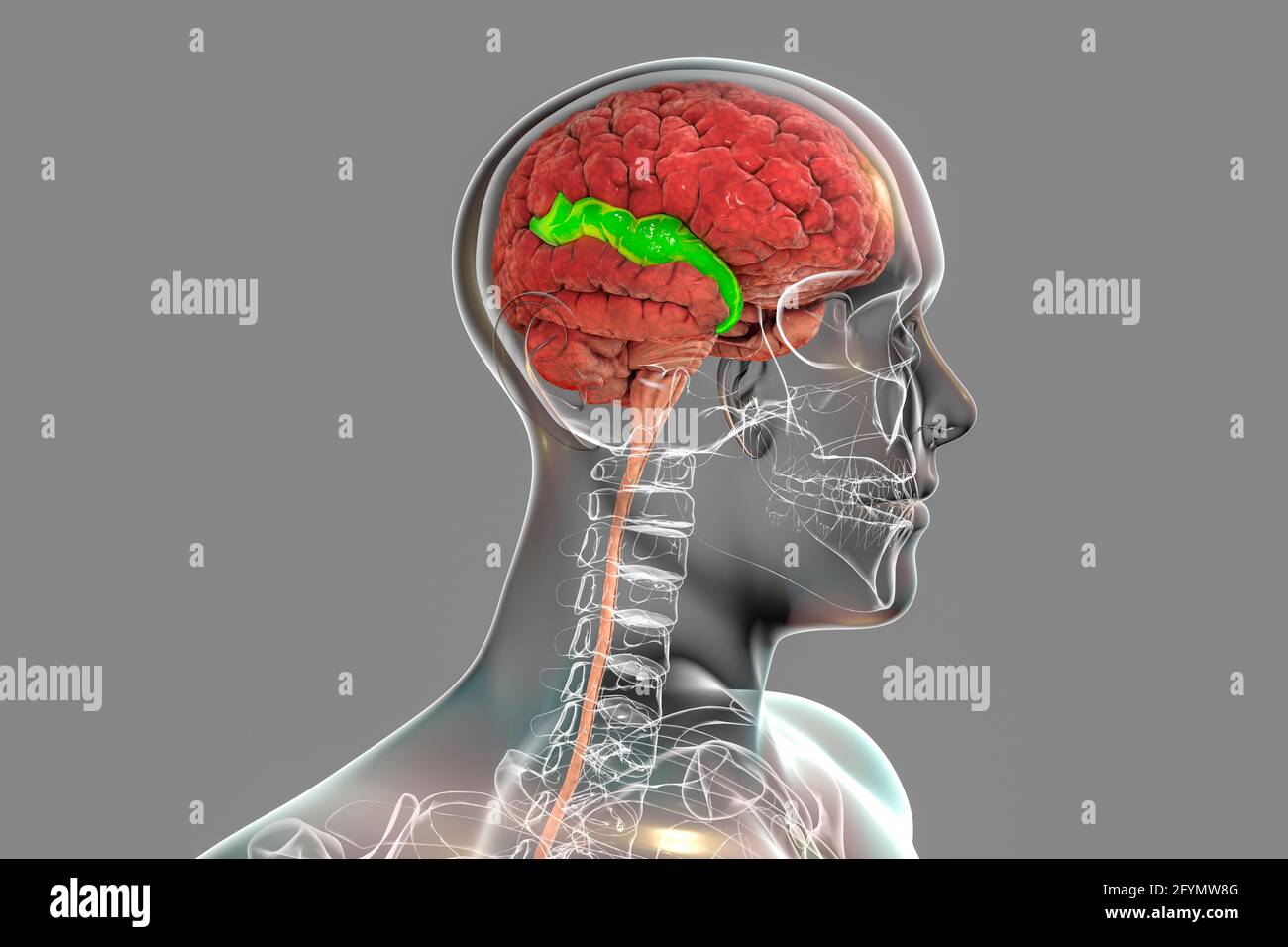 Brain with highlighted superior temporal gyrus, illustration Stock ...