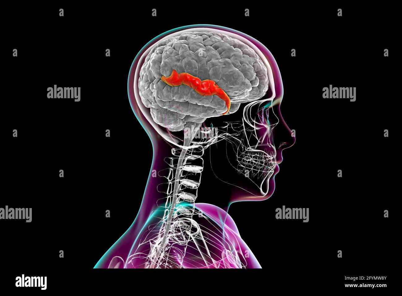 Brain with highlighted superior temporal gyrus, illustration Stock ...