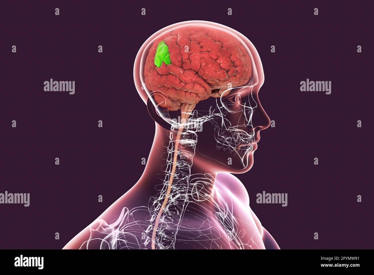 Brain with highlighted supramarginal gyrus, illustration Stock Photo ...