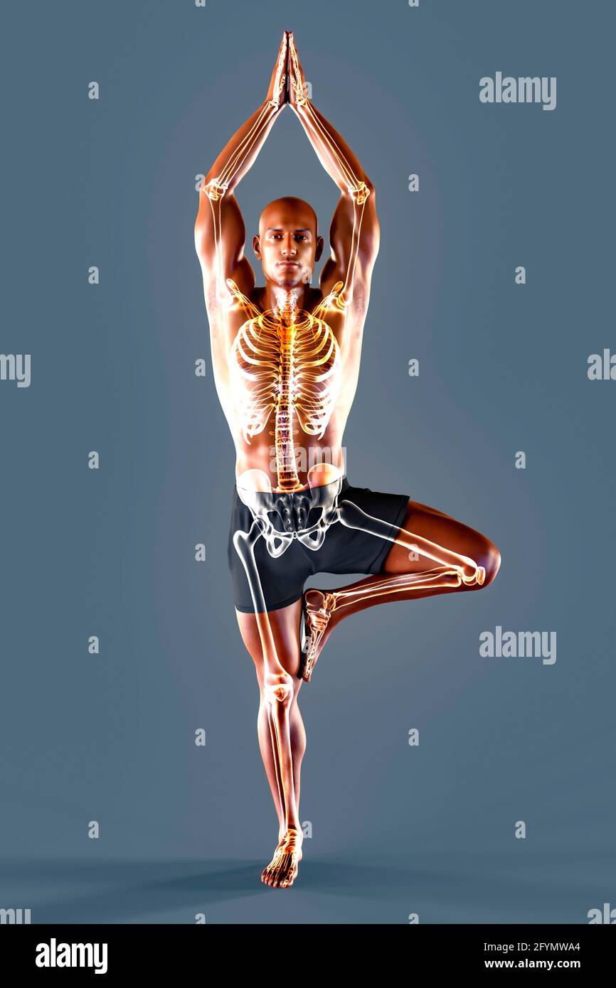 Tree man syndrome hi-res stock photography and images - Alamy