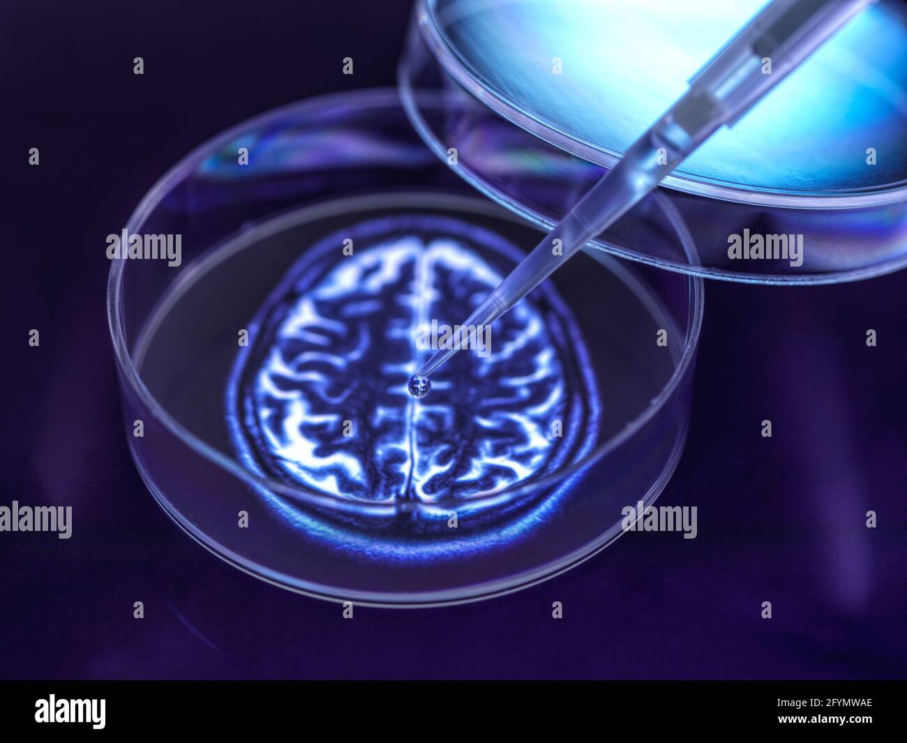 Hospital neurology research hi-res stock photography and images - Alamy