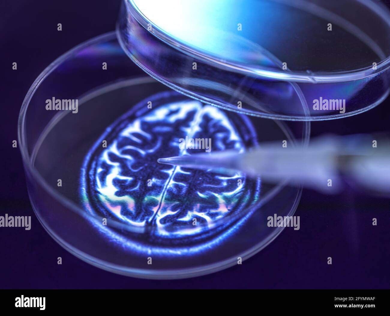 Neurology conceptual hi-res stock photography and images - Alamy