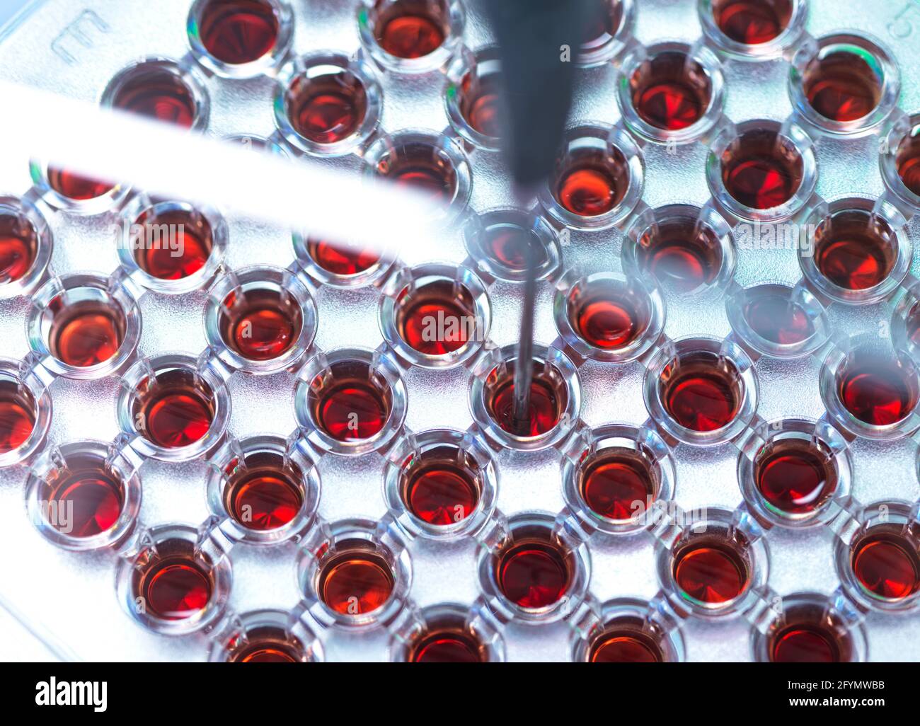 Blood Chemistry Tests High Resolution Stock Photography and Images - Alamy