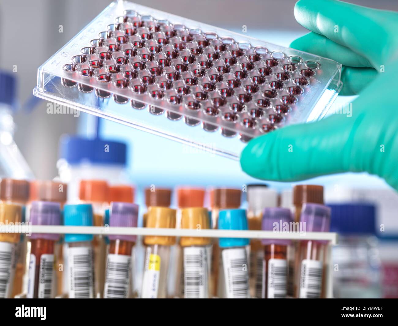 Testing blood and hiv and lab hi-res stock photography and images - Alamy