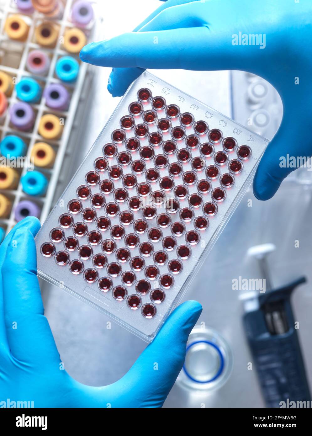Testing blood and hiv and lab hi-res stock photography and images - Alamy