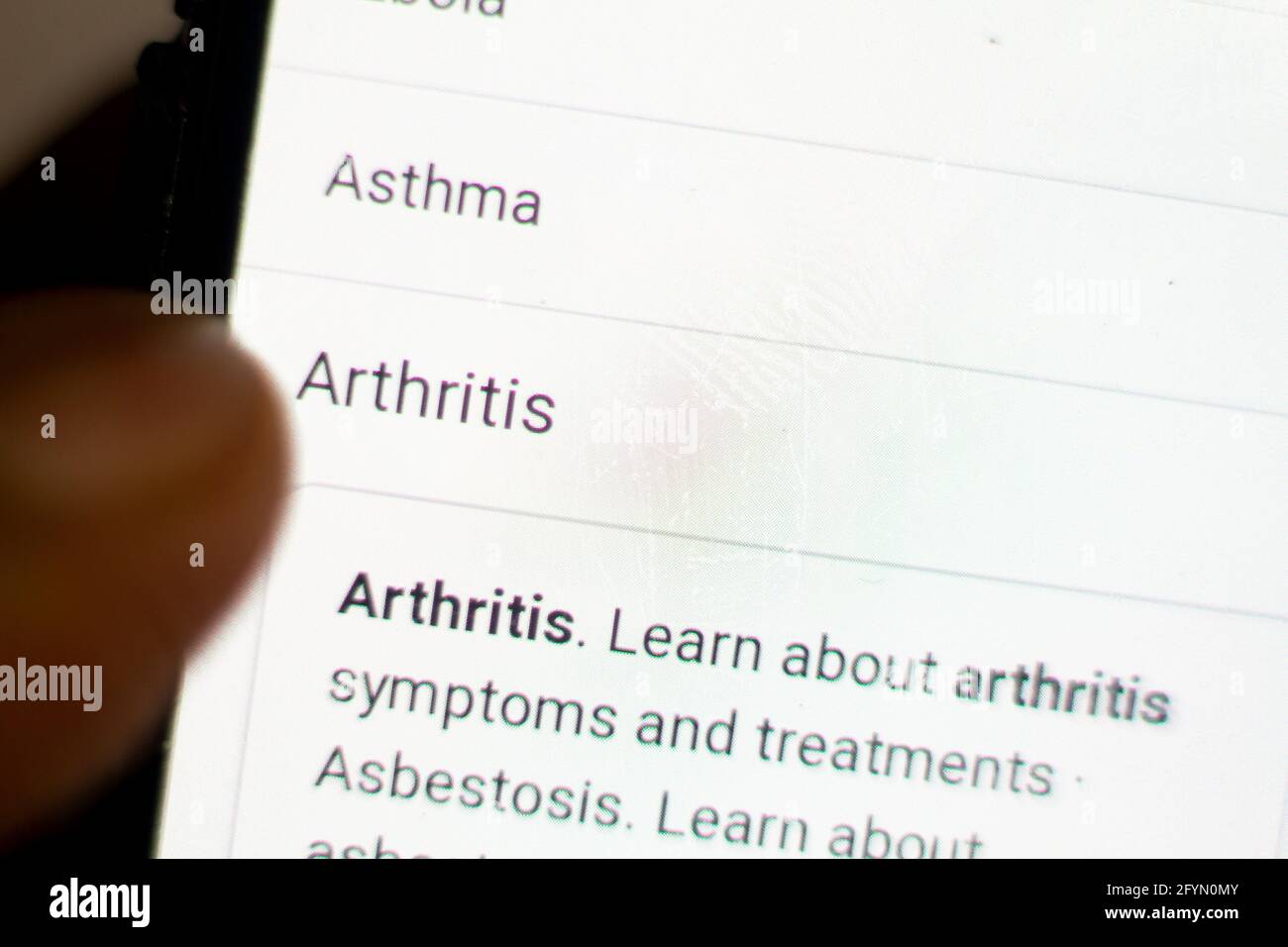 Hand on knee female hurt hi-res stock photography and images - Alamy