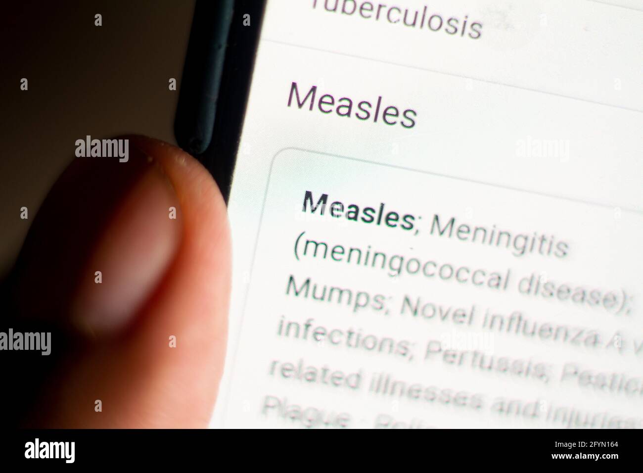 Skin rash eczema on hands hi-res stock photography and images - Alamy