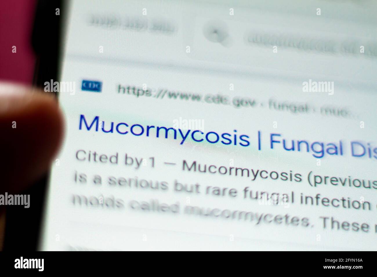 Fungal disease prevention hi-res stock photography and images - Alamy