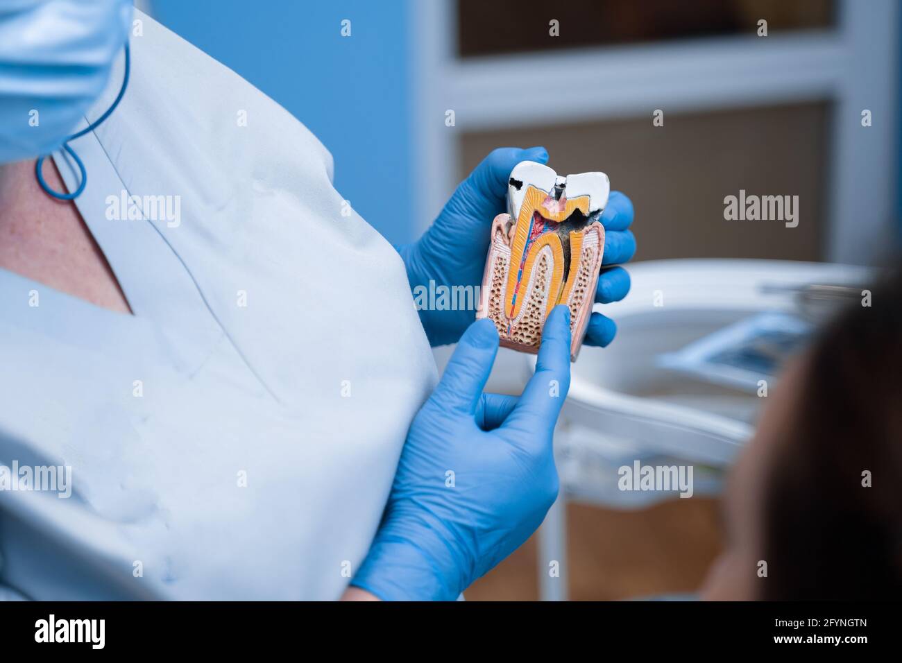 Dummy of a sick tooth with caries, Dentist shows structure of the teeth ...
