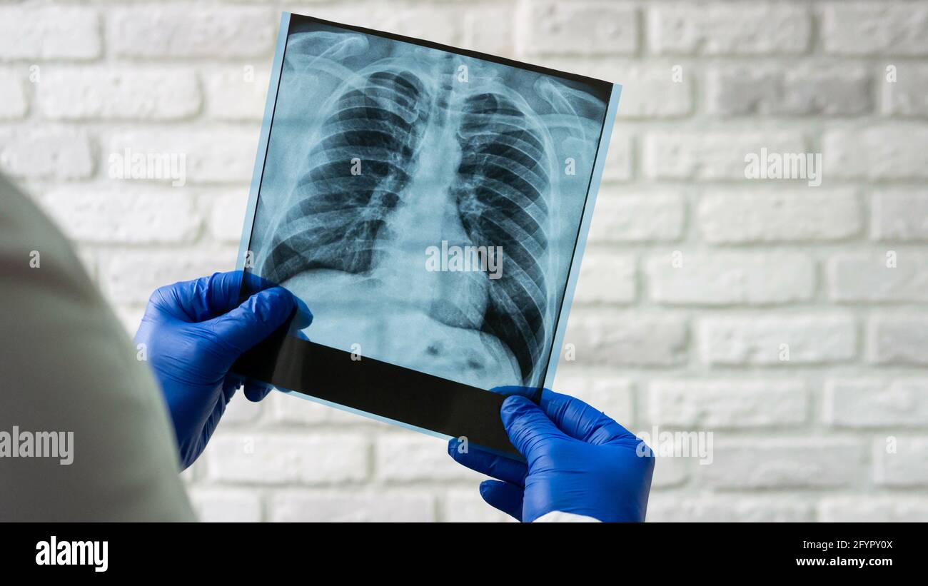 X-ray of human lungs. The doctor diagnoses the patient. Chest X-ray ...