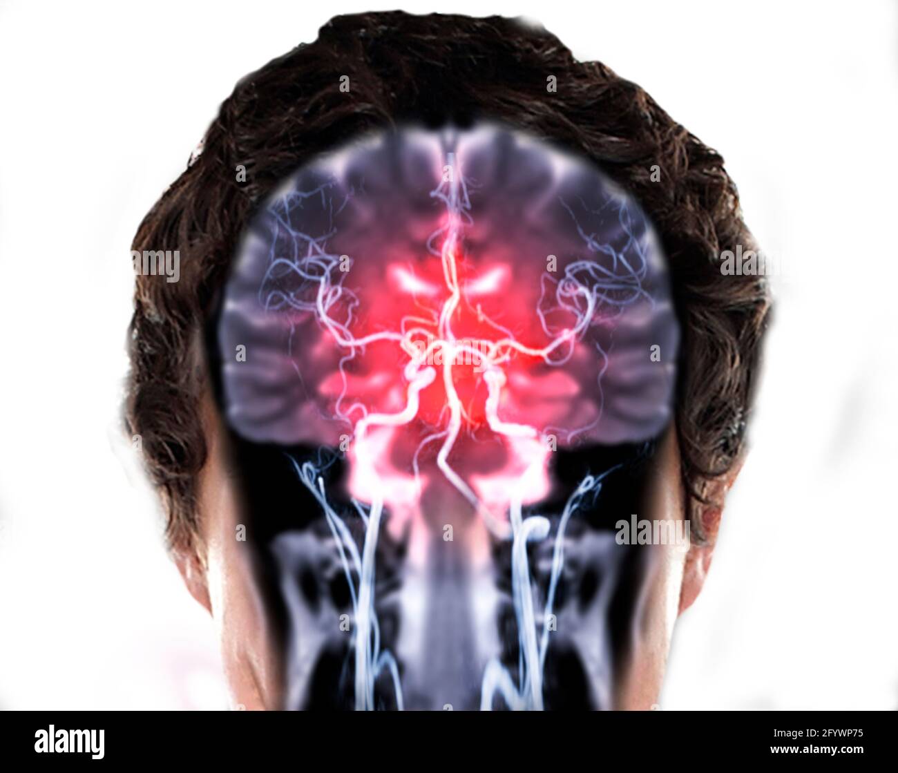 Human brain axial mri scan hi-res stock photography and images - Alamy