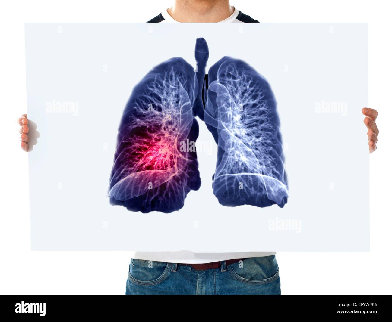 3d man lung hi-res stock photography and images - Alamy