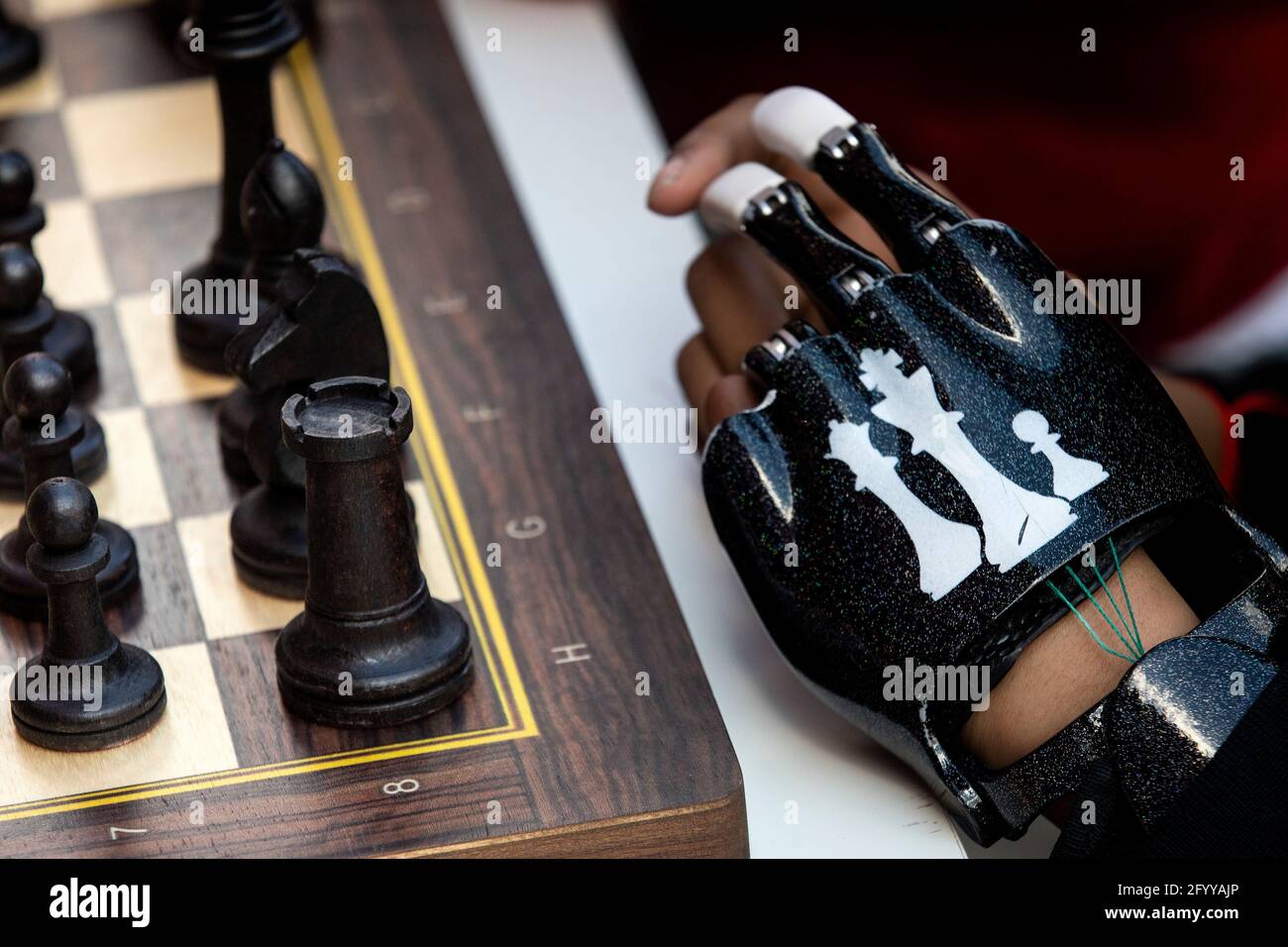 A child with a bionic prosthetic arm plays chess Stock Photo - Alamy
