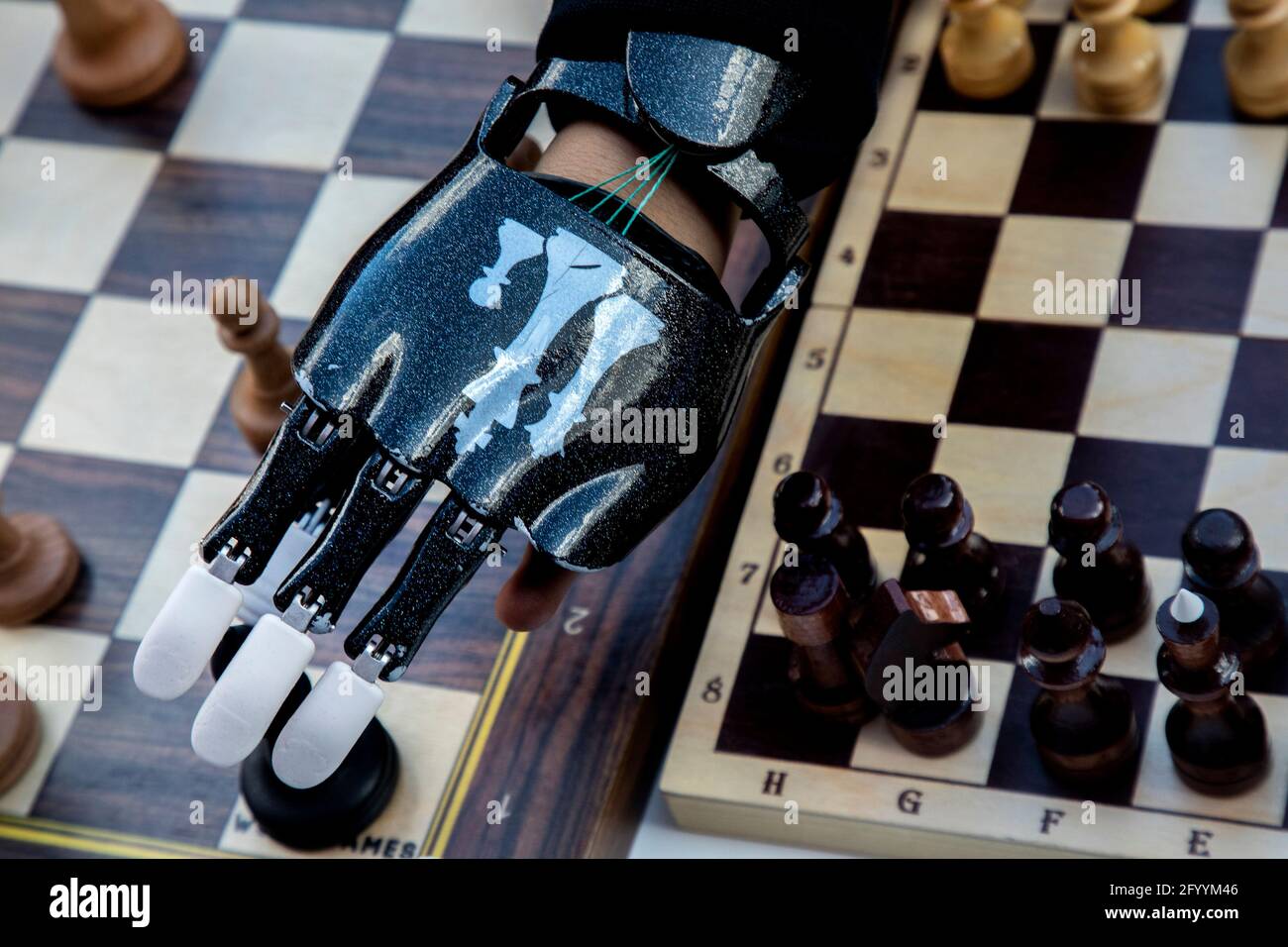 A child with a bionic prosthetic arm plays chess Stock Photo - Alamy