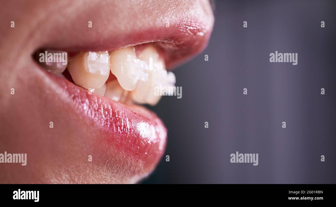 Horizontal close-up snapshot of beautiful woman's smile, demonstrating ...
