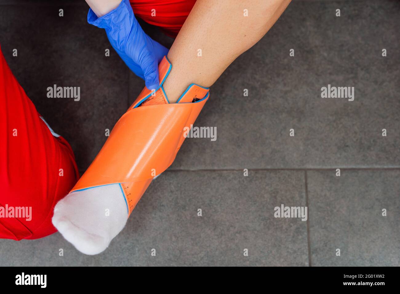 First Aid training. Leg injury. Training Concept Stock Photo - Alamy