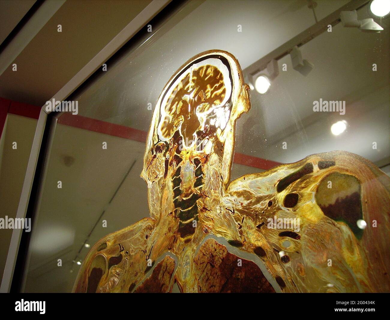 Sectioned man - male human plasticised and sectioned on display at the ...