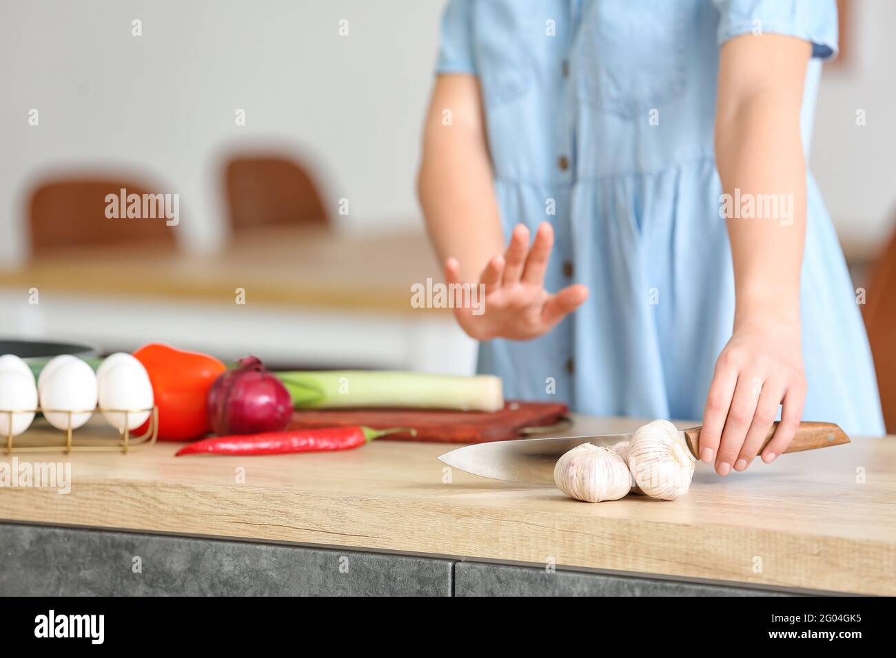 Young woman with food allergy in kitchen Stock Photo - Alamy
