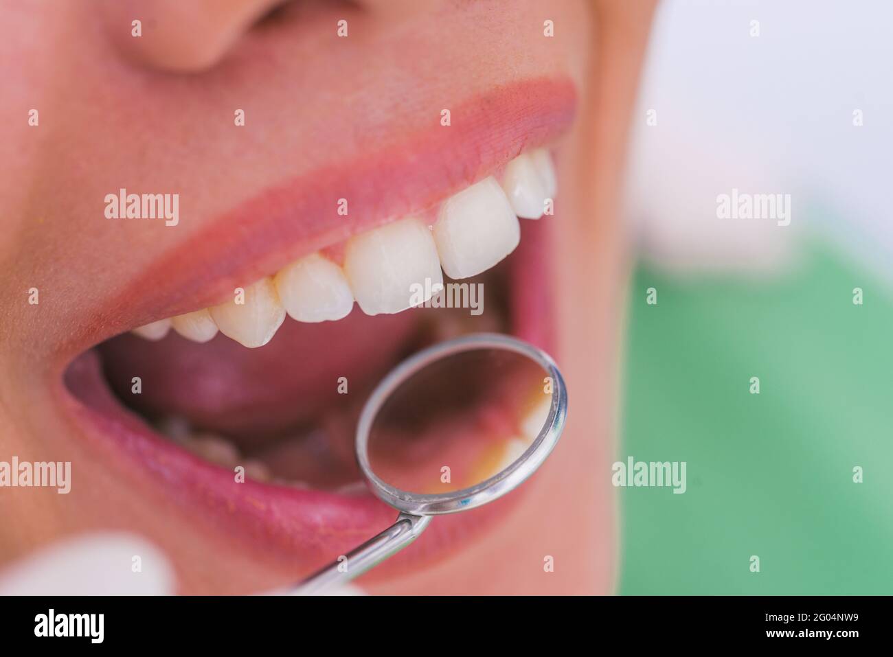 Closeup of a female patient with an open mouth during oral checkup at ...
