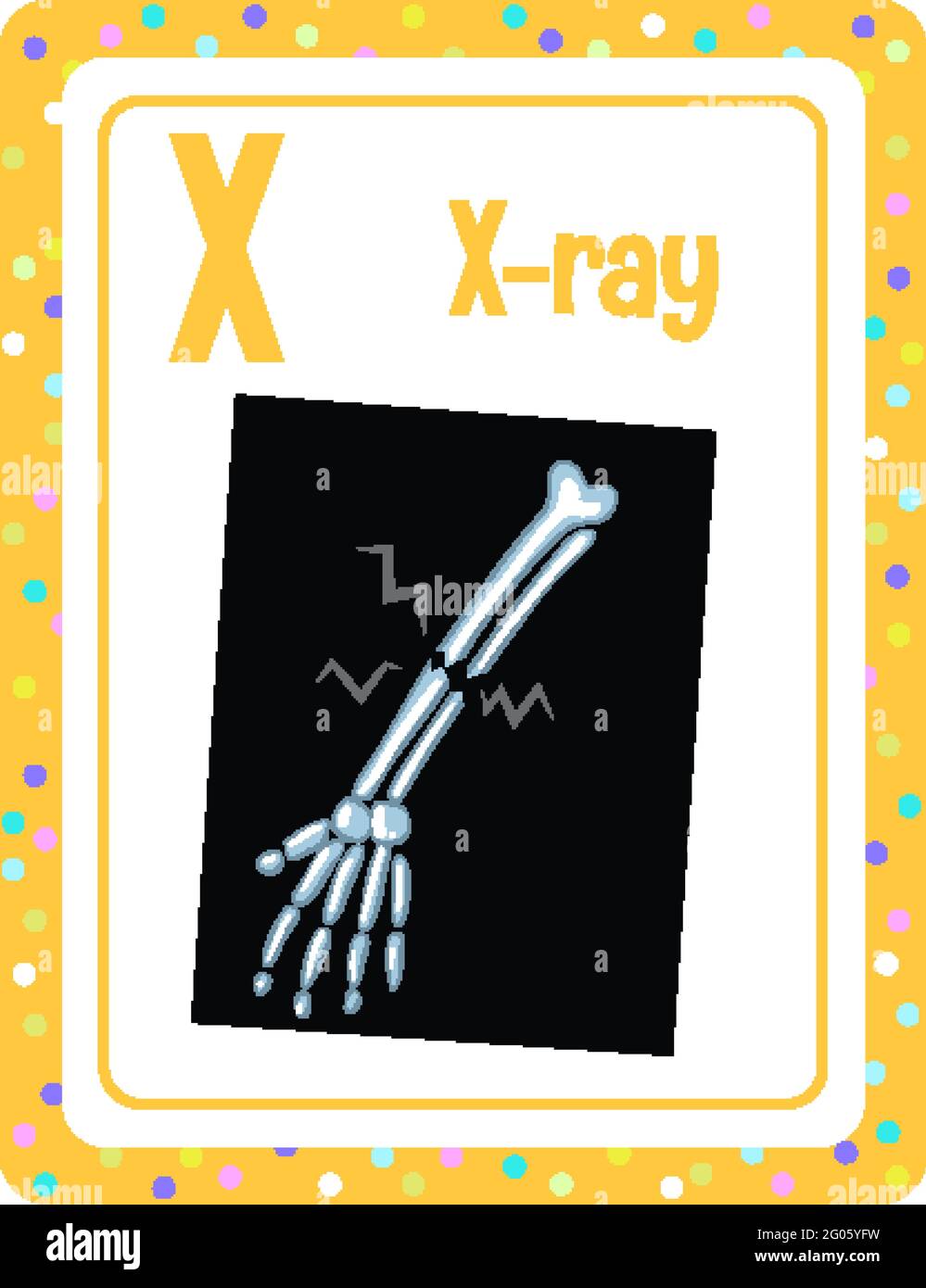 Alphabet flashcard with letter X for X-ray illustration Stock Vector ...