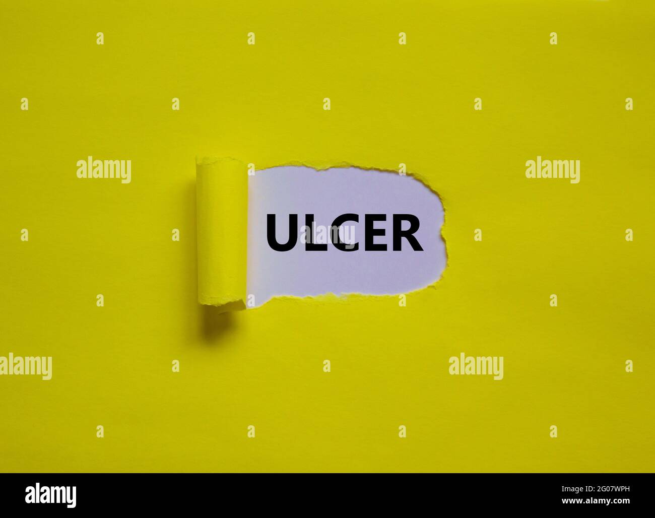 Medical and ulcer symbol. The concept word 'ulcer' appearing behind ...