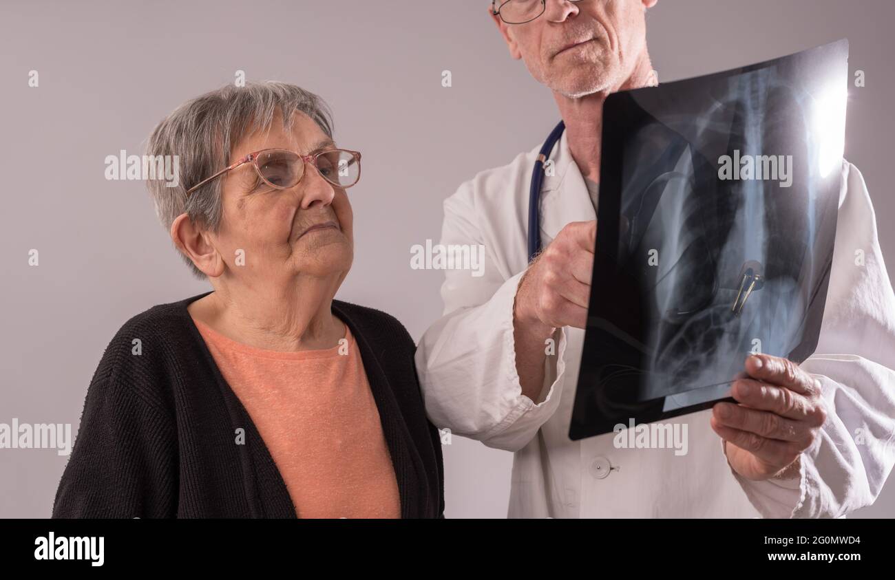 Doctor showing a radiography to his elderly patient Stock Photo - Alamy