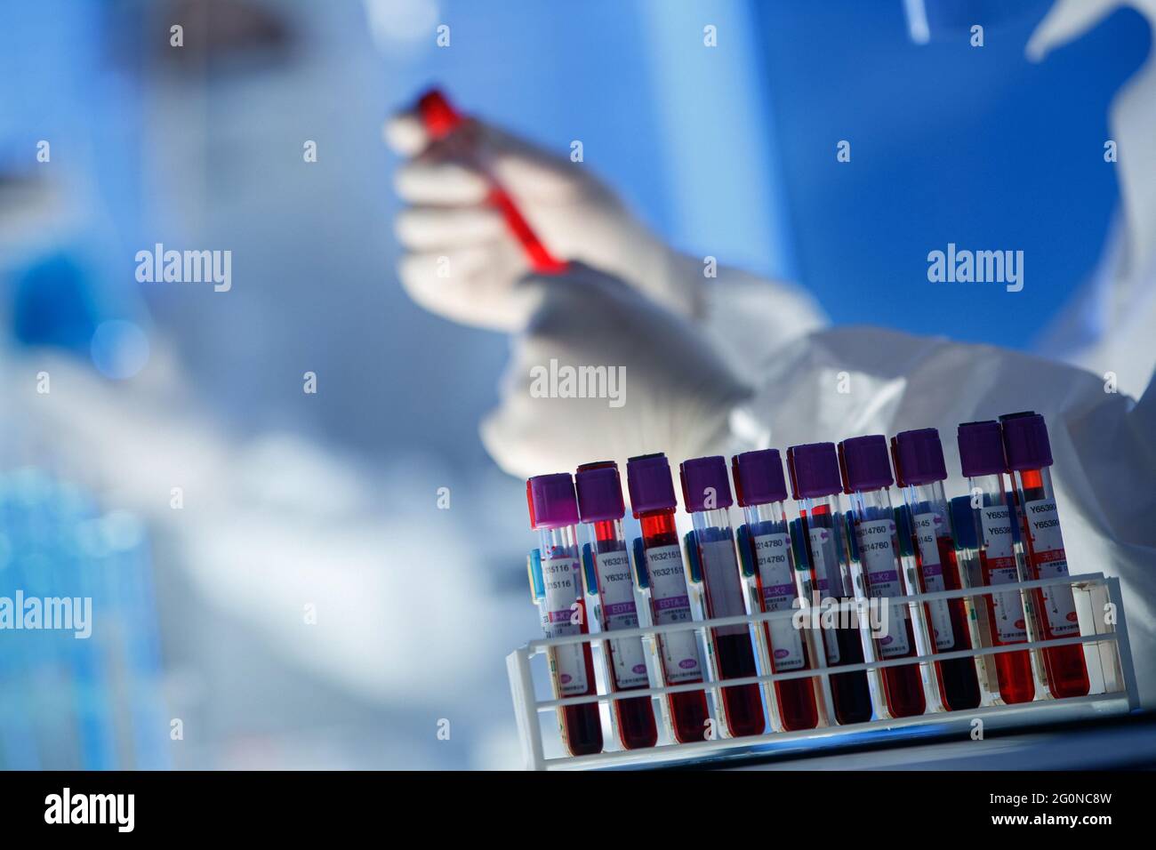 Laboratory workers watching medical hi-res stock photography and images ...