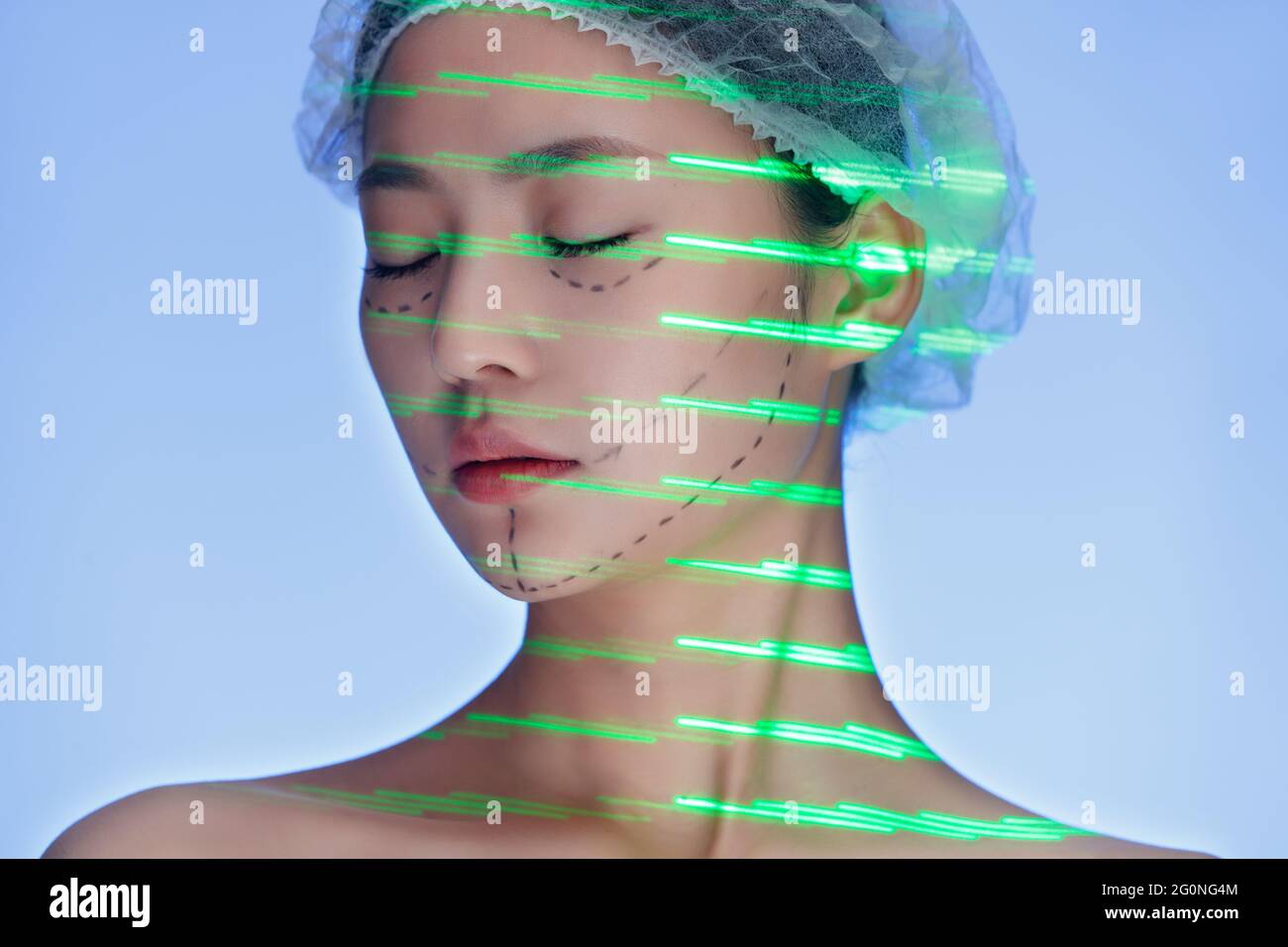 Laser scan skin hi-res stock photography and images - Alamy